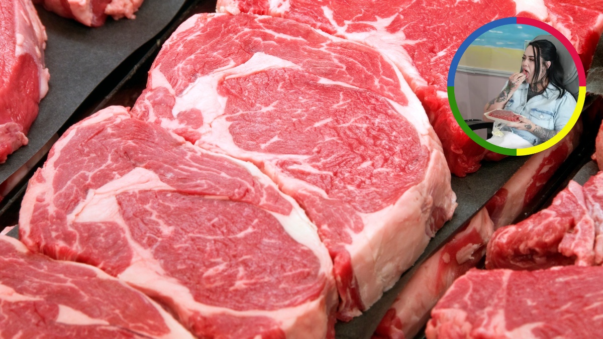 A woman’s extreme raw meat diet seemed fine until a medical test ...